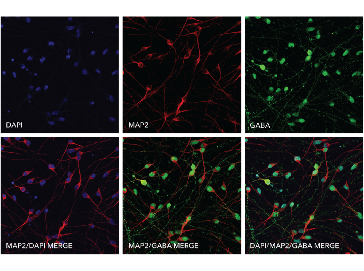 4 Top Tips For Culturing Ipsc Derived Gabaergic Neurons